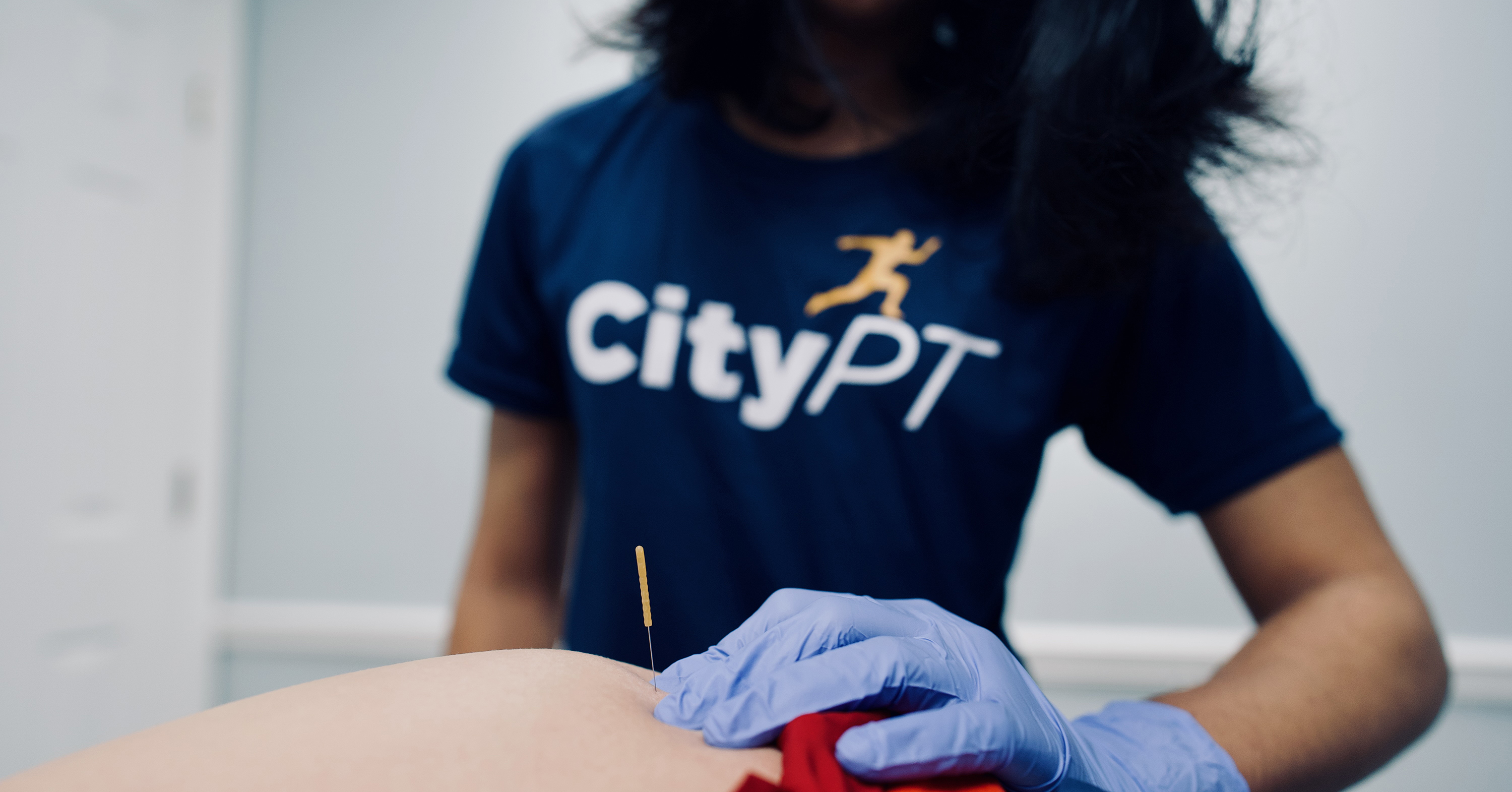 Dry Needling vs. Acupuncture: Which Is Better for Athletes? - CityPT Dry Needling vs. Acupuncture: Which Is Better for Athletes? - CityPT