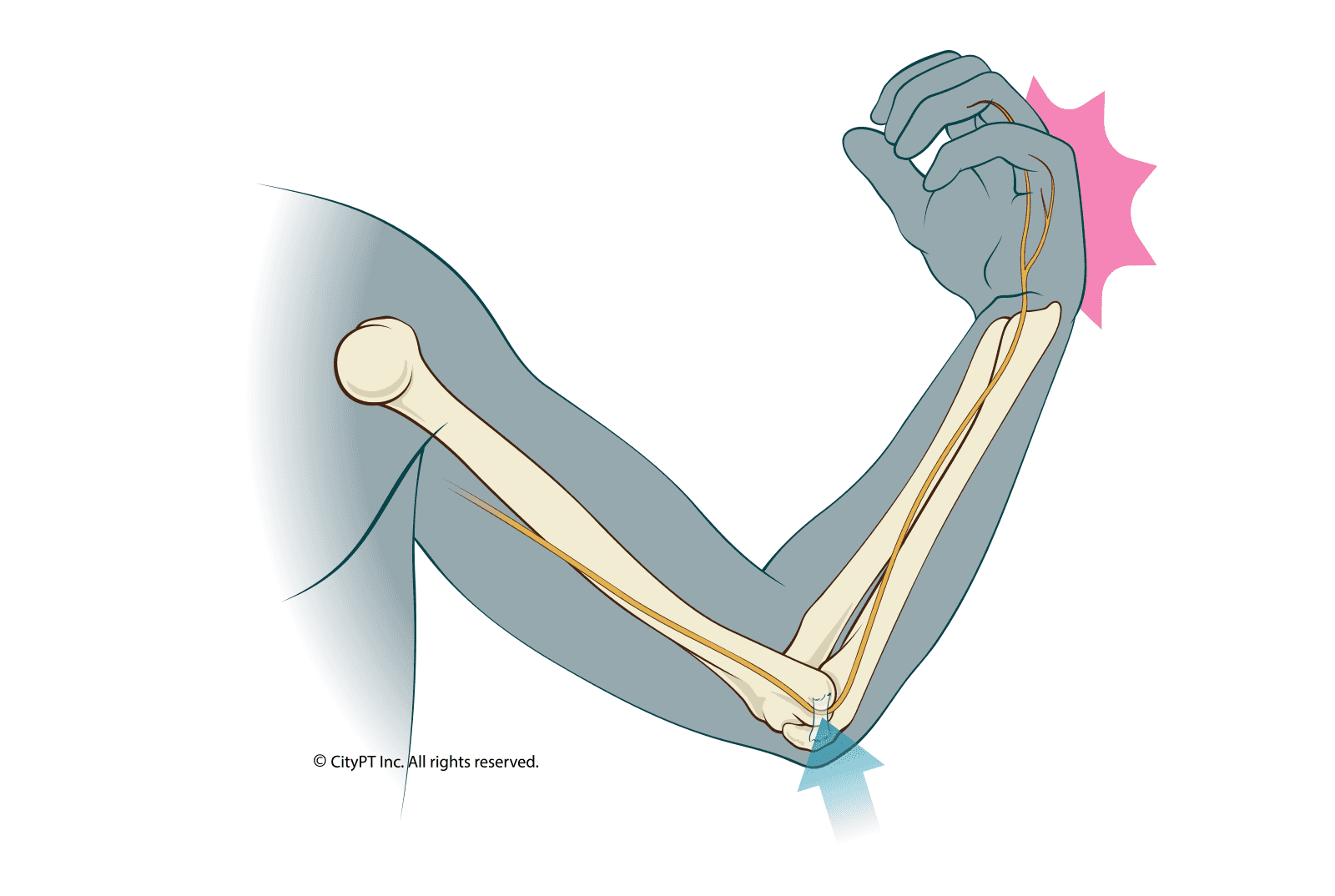 An Occupational Therapy Guide To Cubital Tunnel Syndrome CityPT an-occupational-therapy-guide-to-cubital-tunnel-syndrome-citypt